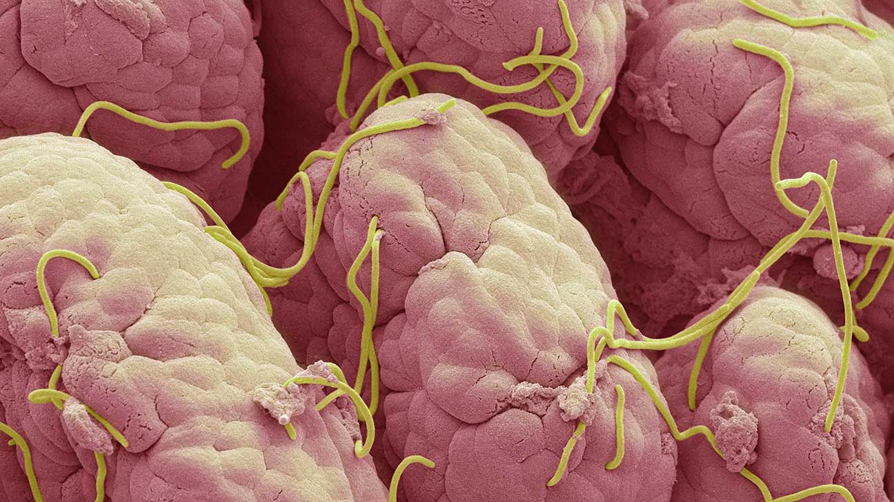 Itchy Vagina Causes, Symptoms, Treatments and Remedies - American Celiac