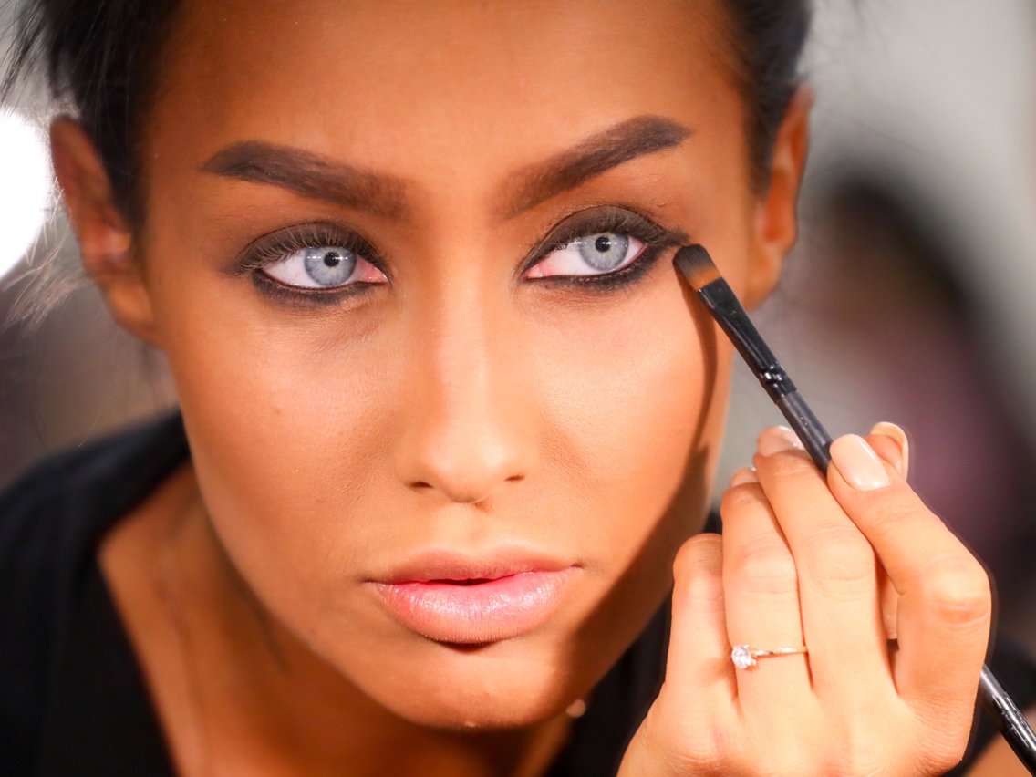 Red Ring Around Iris, Eyelids, Eye Socket, In Babies & More - American ...