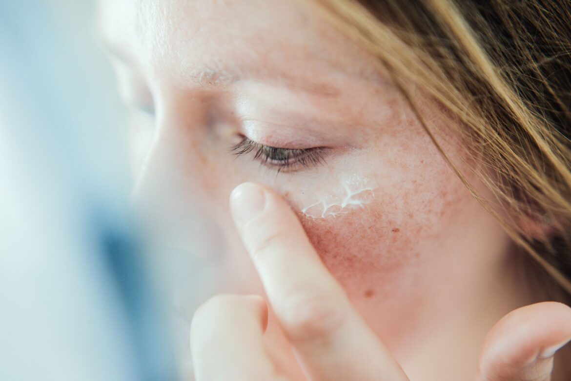 Scabs on Face Meaning, Symptoms, Causes and Getting Rid of Them Fast ...