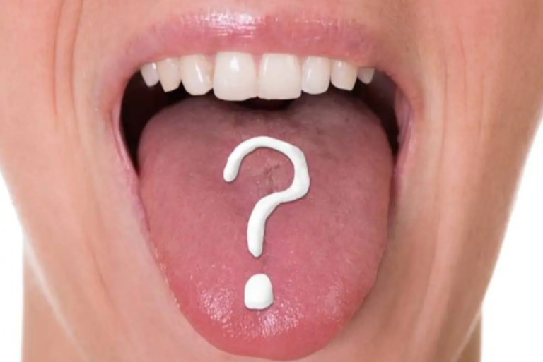 Swollen Taste Buds Causes, Getting Rid of Tip, Back Tongue Enlarged ...