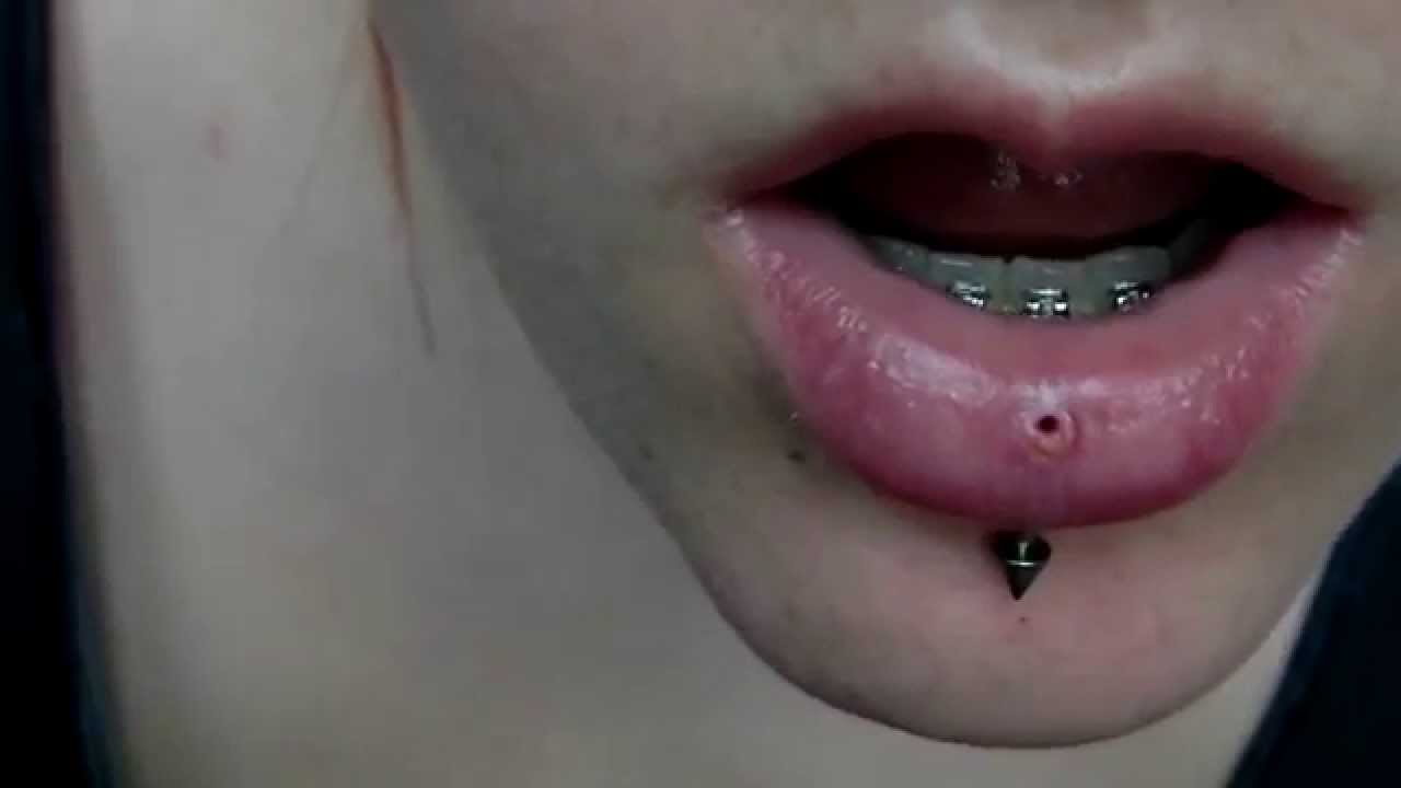Horizontal Lip Piercing Jewelry, Pain, Scar and Pictures - American Celiac