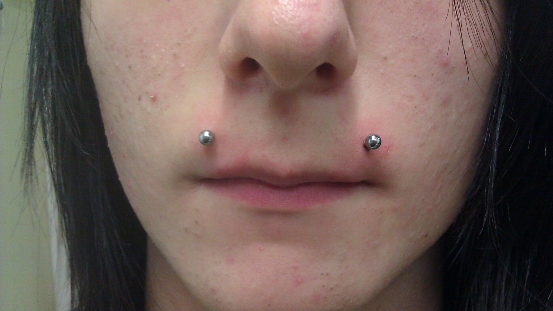 Angel Bites Piercing Pain, Scars, Jewelry, Pictures and How To Pierce ...