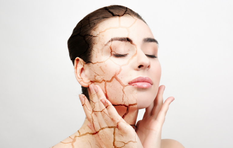 Crusty Behind Ears Causes, Symptoms, Dry Skin, Psoriasis, Skin ...