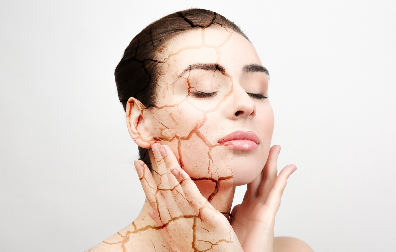 Crusty Behind Ears Causes, Symptoms, Dry Skin, Psoriasis, Skin ...