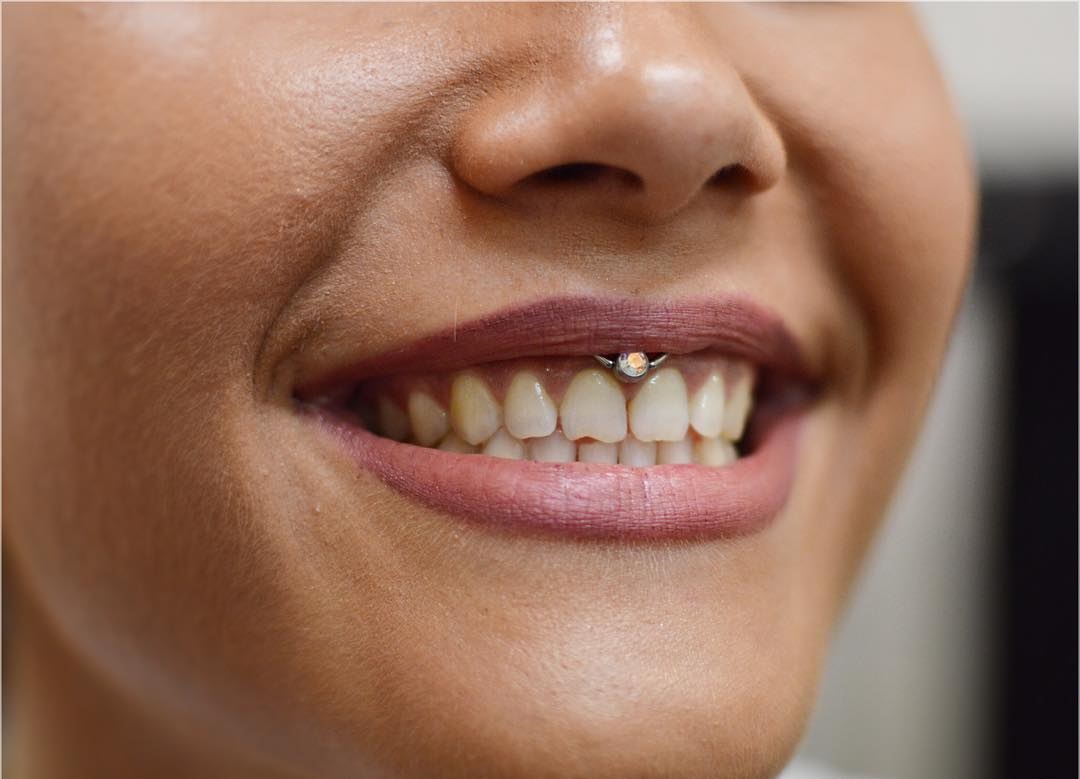 Smiley Piercing, Anti-Smiley Pictures, Cost, Healing, Infection, Risks ...