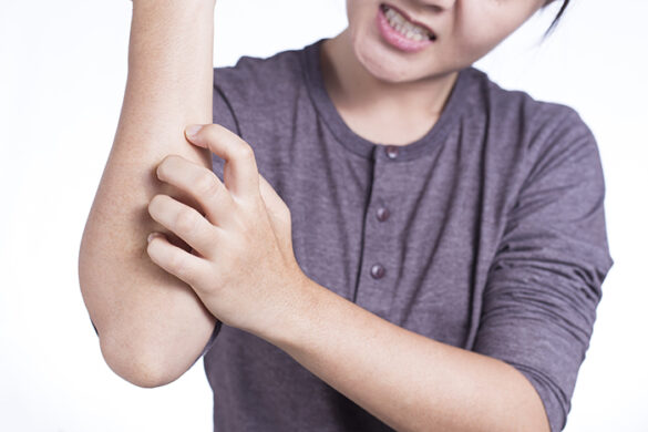 Itchy Elbows Causes, Symptoms, Rash, Bumps, Treatments and Home ...