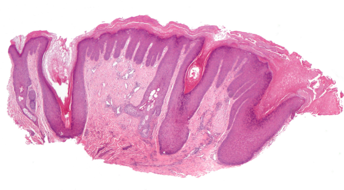 Rash on Neck Meaning, Causes, Itchy, Red, Bumpy Rash, Diagnosis and ...