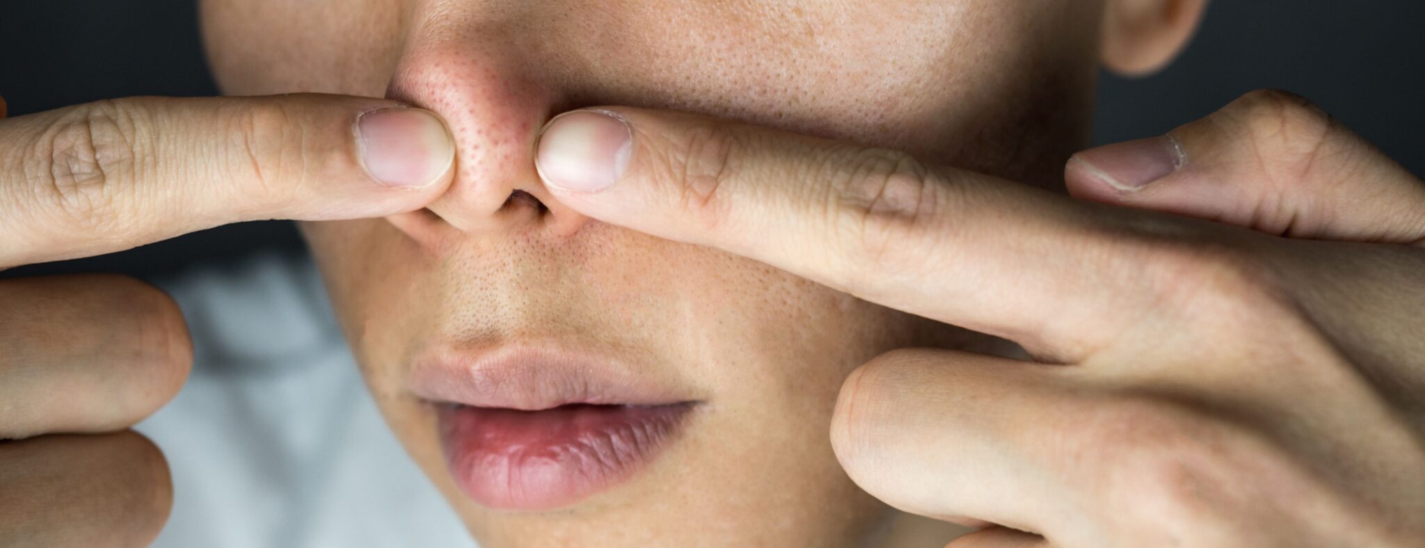 How to Remove Blackhead from Nose, Best Ways, Cleaning, Squeezing ...