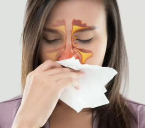 Puffy Cheeks Causes, Symptoms, How to Get Rid of Cheek Puffiness ...