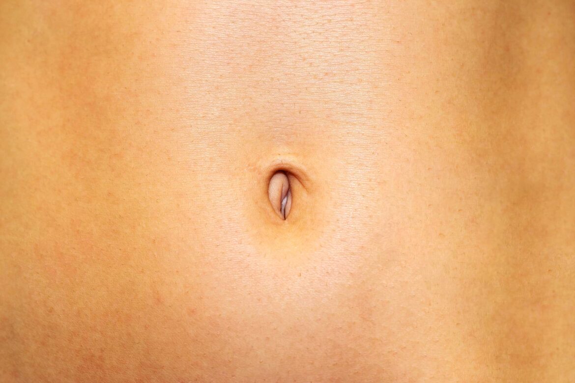 Belly Button Discharge – Causes, Yeast, Smelly White, Brown, Yellow ...
