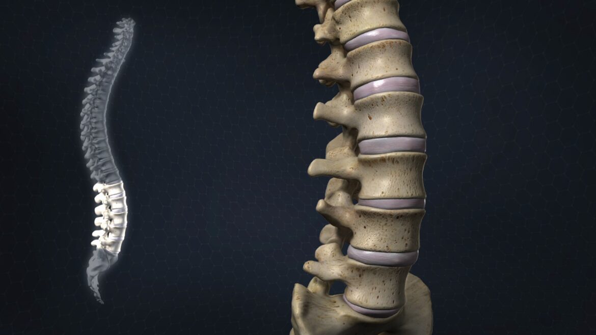 Laminectomy Of The Spine - Indications, Surgery Technique ...