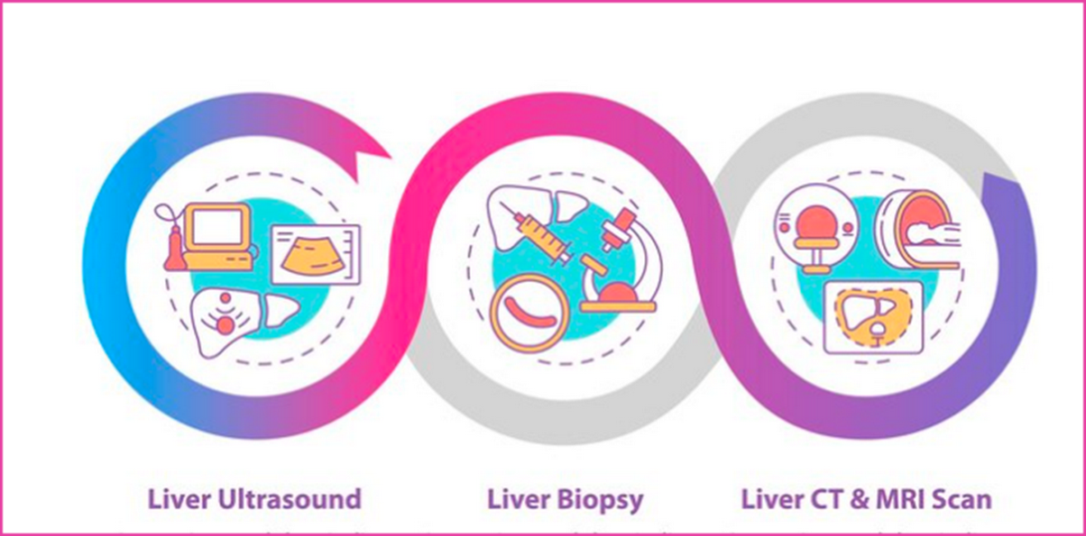 Nonalcoholic Fatty Liver Diseases: Advanced Testing and Treatment ...