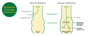 Dairy and Digestion: Understanding Lactose Intolerance and Sensitivity ...
