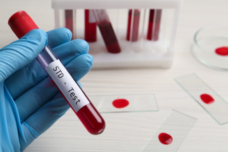 The Importance of Regular STD Testing: When and Why You Should Get ...