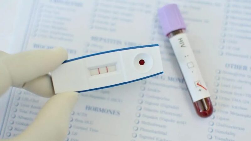 The Importance of Regular STD Testing: When and Why You Should Get ...